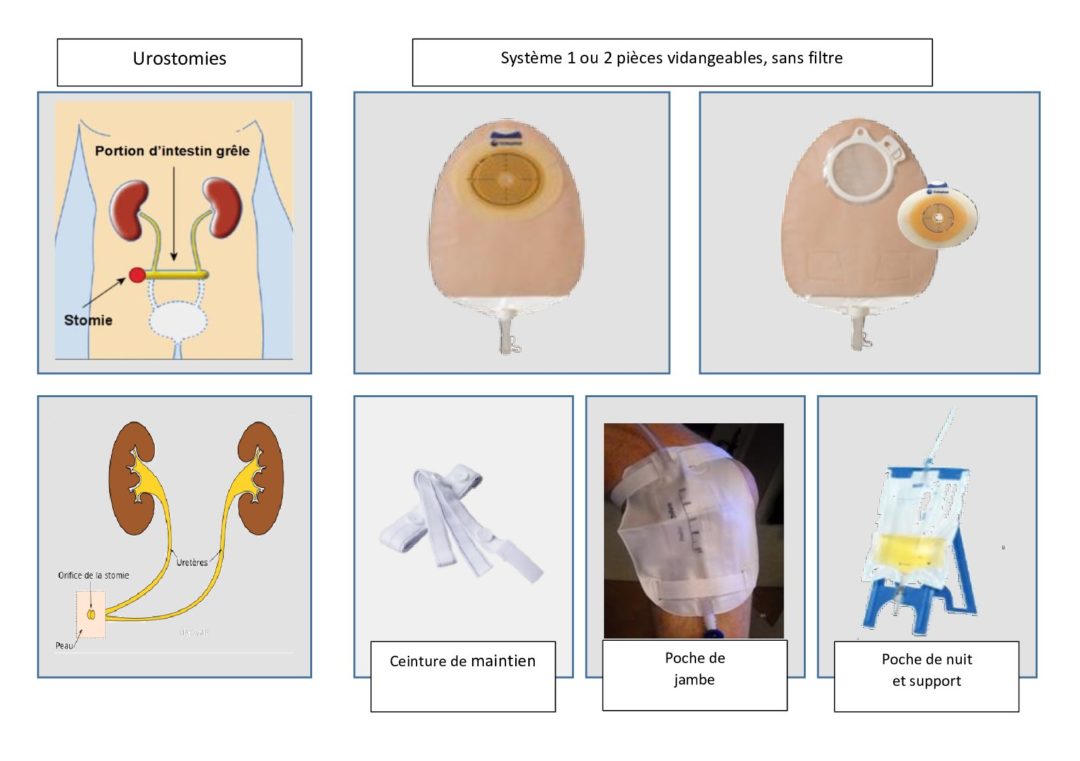 Appareillages stomies urinaires | PROVENCE STOMIE CONTACT